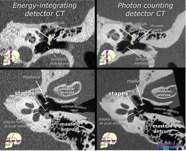 X-ray/CT Technique